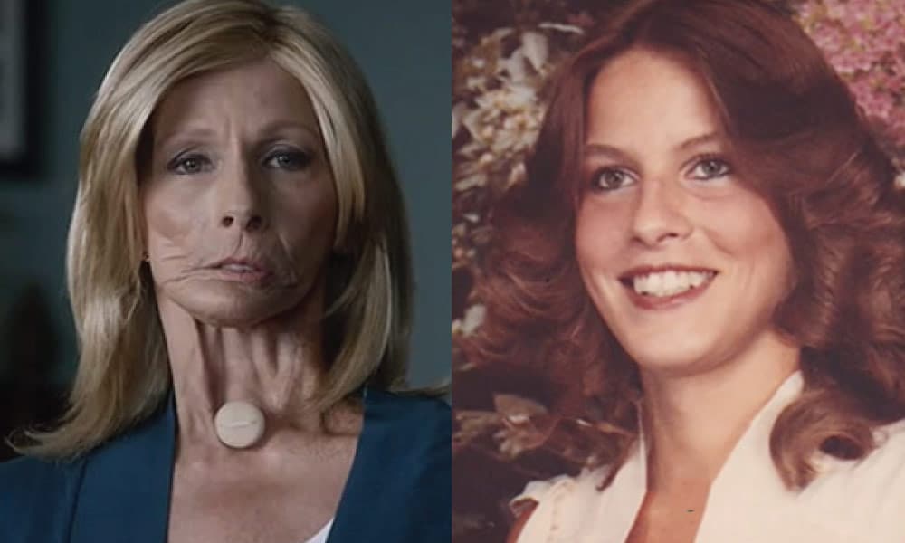 Leher berlubang kerana bertahun 'berasap', kisah Terrie Hall ini ...